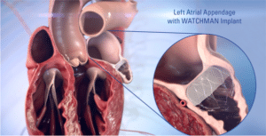 Structural Heart Disease - Heart South